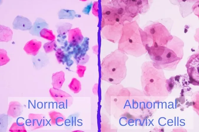 abnormal looking cervix